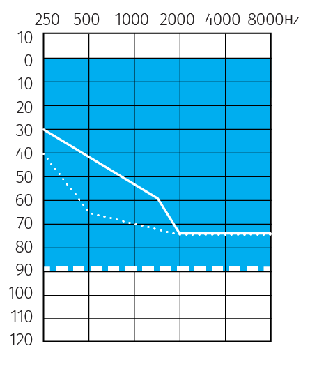Hearing Aid Resources | Professional Tools & Specs | Unitron